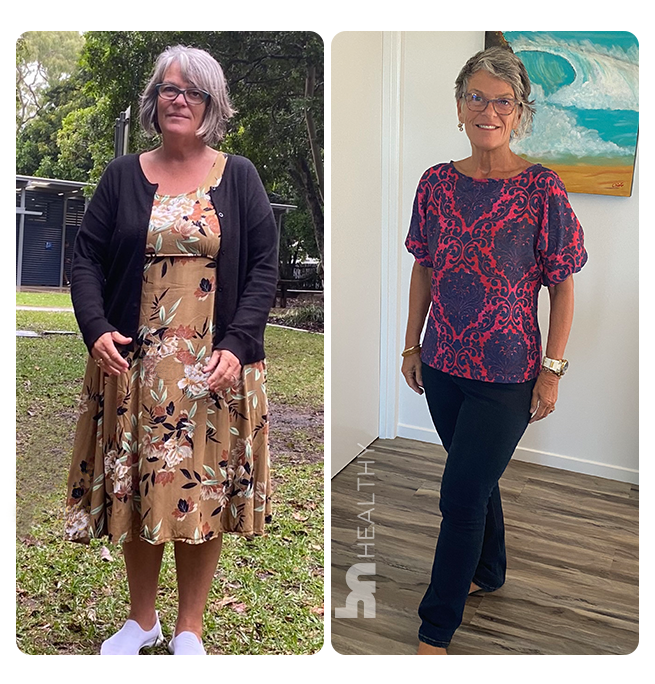 Buy Vitamin Mineral Supplements After Bariatric Surgery Australia buy-vitamin-mineral-supplements-after-bariatric-surgery-australia